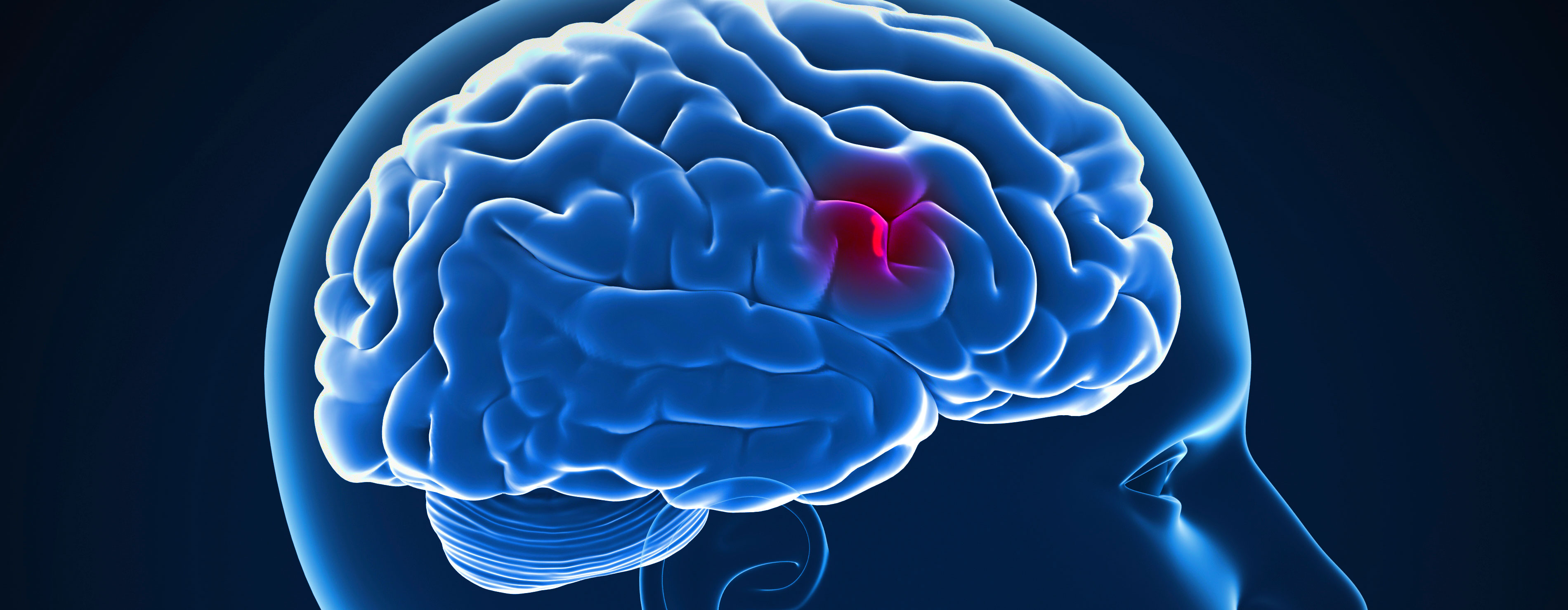 Dos And Don ts When Someone Is Having A Stroke Regency Medical Centre