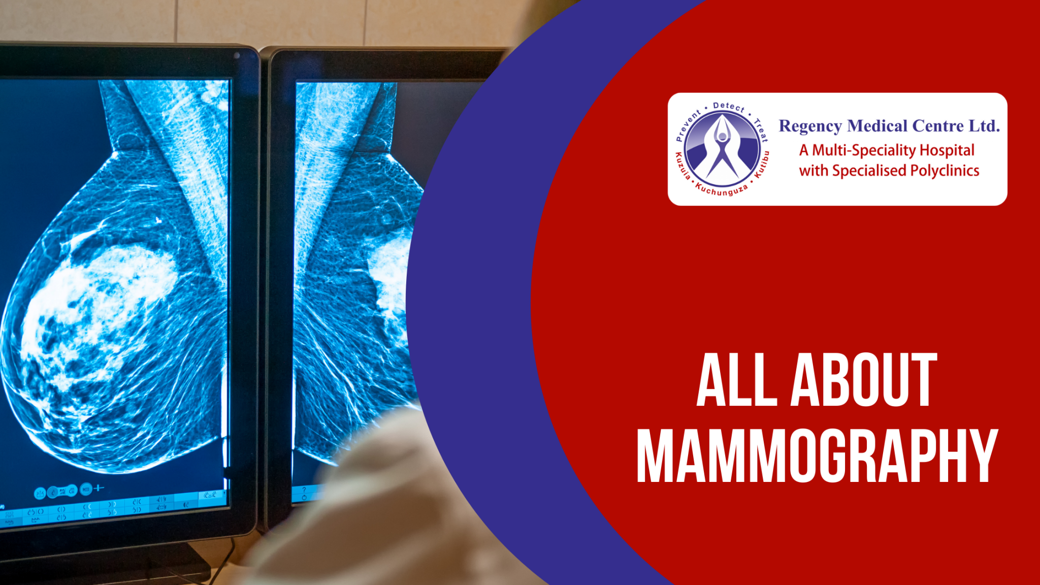 Detail Information About Mammography | Regency Medical Centre